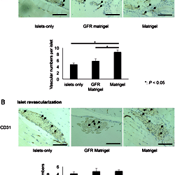 CD31 staining of intramuscularly transplanted islets at POD 14.