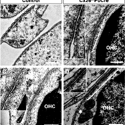 Ultrastructure of the plasma membrane of OHCs.