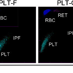 Typical scattergrams of the two flow cytometric platelet count channels ...
