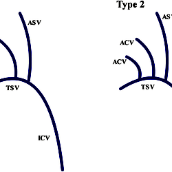 Diagram representingtwo different types of ACV.
