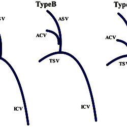 Diagram representingthree different types of ACV.