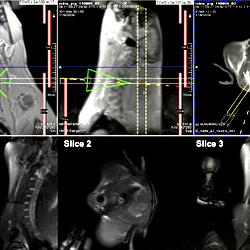 Cervical spine puncture.