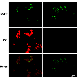 Immunohistochemical staining for PV (red) and EGFP (green) in the ...