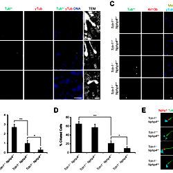 Mouse Tctn1 and Nphp4 have distinct roles in transition zone ...