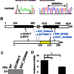 HOXD4 mutations in spinal extradural arachnoid cyst.