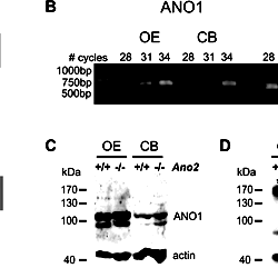 ANO1 and ANO2 expression levels in the cerebellum.