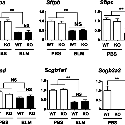 Analysis of mRNAs for surfactant proteins and SCGB proteins.