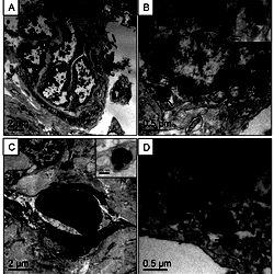 Electron micrographs of capuchin monkey spleen tissue.
