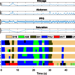 Representative signals.