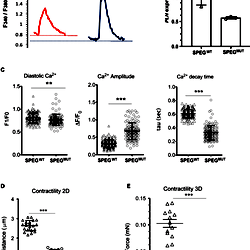 Functional characterization of SPEG mutant iPSC-CMs.