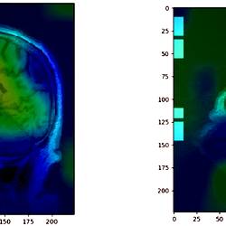 Classification activation mapping.