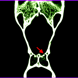 Determining of the rostral border of the presphenoid bone point (RPB).