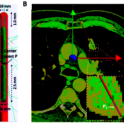 Geometric characteristics of VS2000 source & setup array in lung tumor.