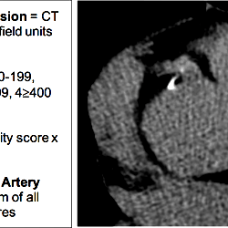 CAC scoring methodology and example image.