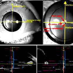 Definition for all parameters in different cross-sectional views.