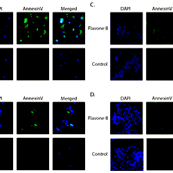 Annexin V assay.