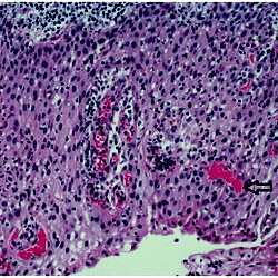 High power magnification of histological section (H & E staining ...