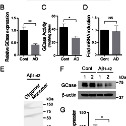 GCase protein levels and activity are reduced in sporadic AD brain ...