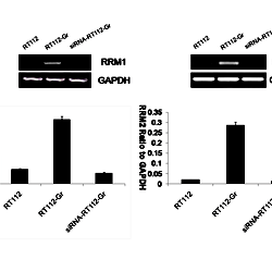 Expression of RRM1 and RRM2 in bladder cancer cell lines.