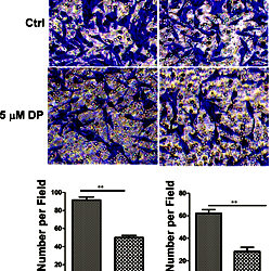 Effects of DP on SW620 cell migration and invasion in vitro.