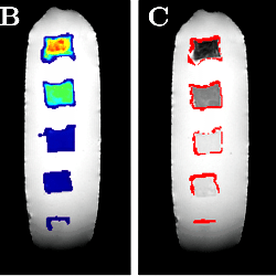 Overlay of the MRI magnitude data (grayscale) and SVM results (color ...