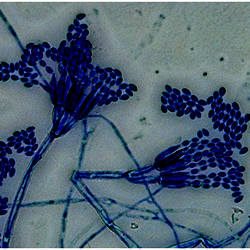 Micromorphology of T. radicus—CrP20, showing phialides with chains of ...