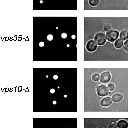 Cell Tracker Blue staining of vacuoles.