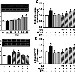 Possible role of AMPK activation in mediating the antihypertrophic ...