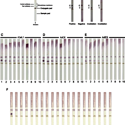 An immunochromatographic (IC) strip test is developed for diagnosis of ...