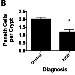 Human preterm infants diagnosed with IUGR have decreased Paneth cell ...