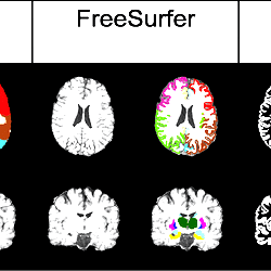 Segmentation obtained through different software packages with the ...