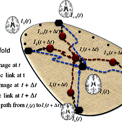 Registration via graph shrinkage.