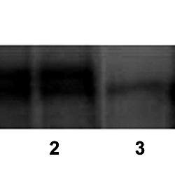 Western blot for FANCD2 monoubiquitination detection.
