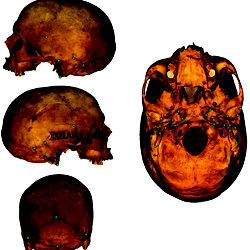 Location of the 34 landmarks used to capture the shape of the basicranium.