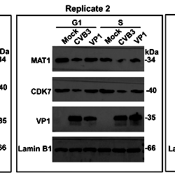 The expression of MAT1 and CDK7 in nucleus of cells infected with CVB3 ...