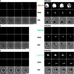Z-sections of images from Fig 1A, showing subcellular localisation of ...