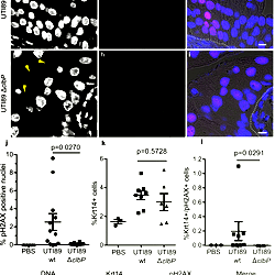 Colibactin induces DNA damage in urothelial cells of the regenerative ...
