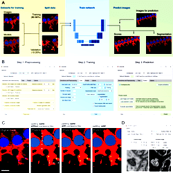 Schematic presentation of DeepMIB deep learning workflow.