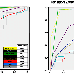PI-RADS v2.1 shows excellent performance in assessing DCE.