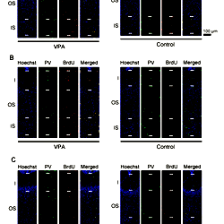 Parvalbumin neuron immunofluorescence with BrdU labeling and Hoechst ...