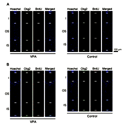 Olig2 immunofluorescence with BrdU labeling and Hoechst staining in ...