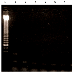 Gel electropherogram of the amplification products of the mummy´s tissues.