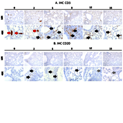 Immunohistochemical staining reveals a high infiltration of CD3+ T ...