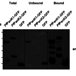 GFP-Trap immunoprecipitation of proteins from PfPanK1-GFP, PfPanK2-GFP ...