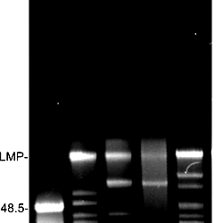 Genomic structure and plasmid analysis of TBRF spirochetes.
