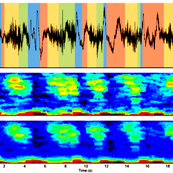 LFP time series and corresponding spectrograms.