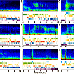 Human EEG spectrograms and corresponding state trajectories.