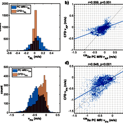 Correlation plots and histograms of agreement for each velocity ...