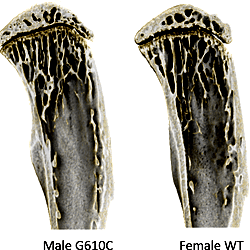 Sagittal tibial cross sections.