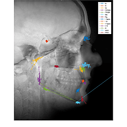 Visualization of landmarks.